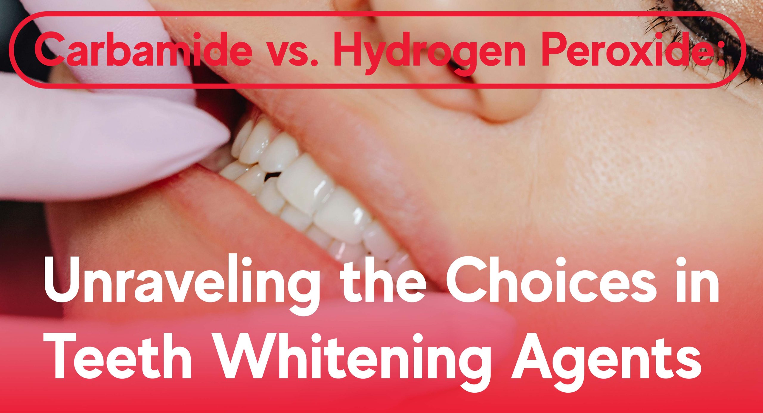 Carbamide Vs Hydrogen Peroxide Two Teeth Whitening Agents